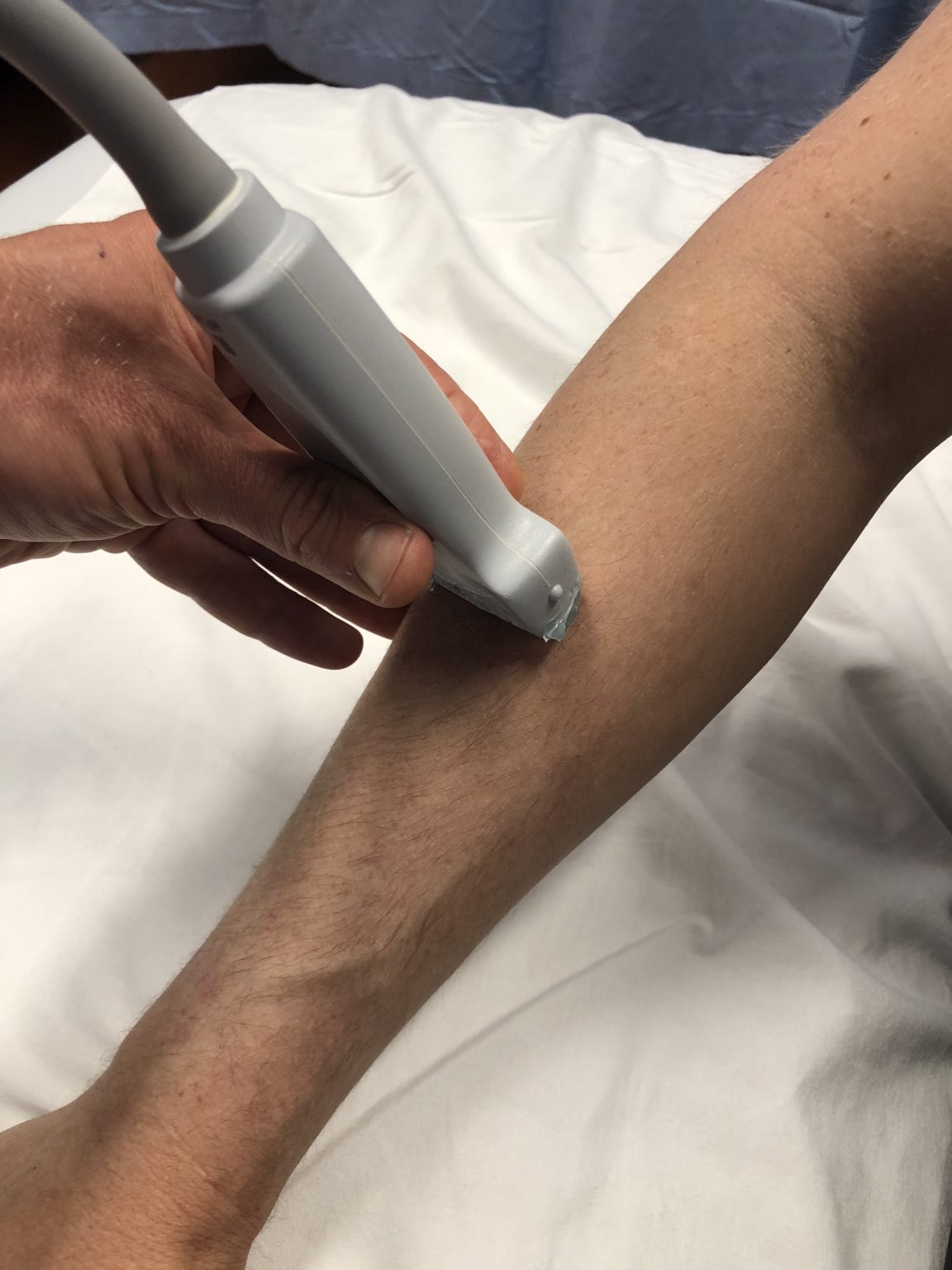 Fracture Identification | BCPoCUS